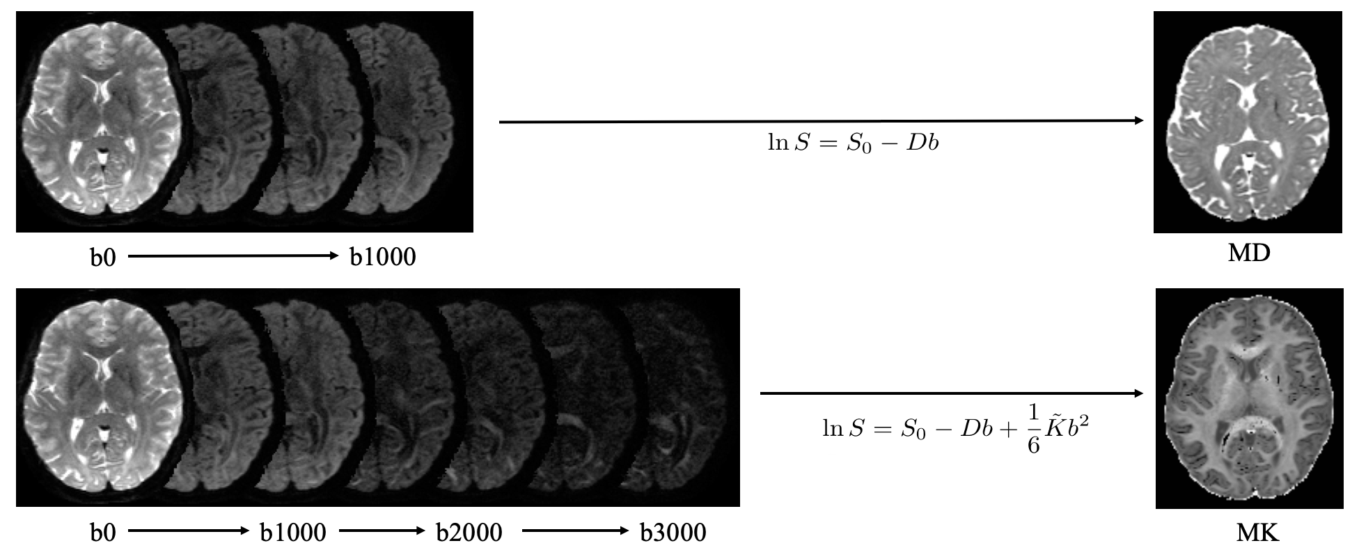 DTI-DKI | NYU Diffusion Biophysics Docs